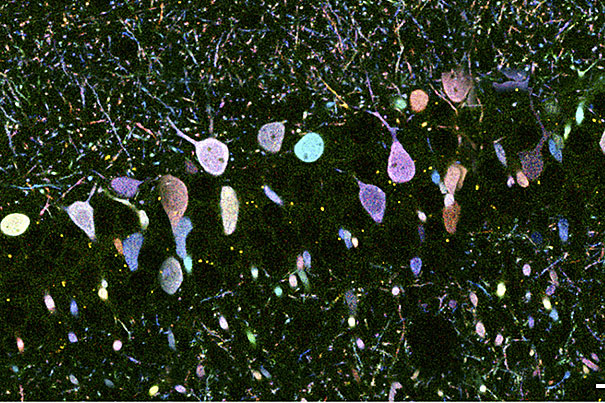 ‘Brainbow,’ version 2.0 — Harvard Gazette