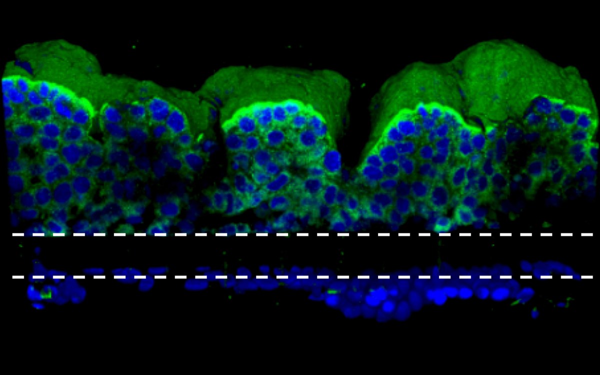 Human body-on-chip platform may speed up drug development — Harvard Gazette