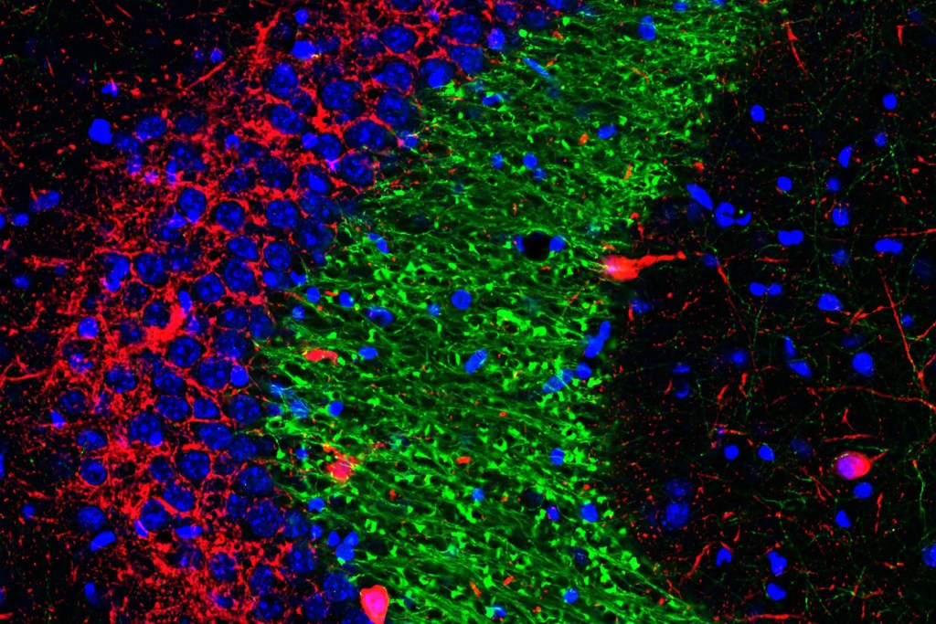 Neural circuit for memory preservation and precision has been ...