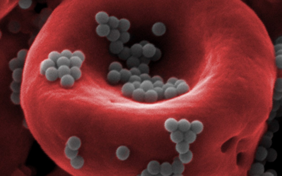 Coated nanoparticles survive immune system and deliver drugs — Harvard ...