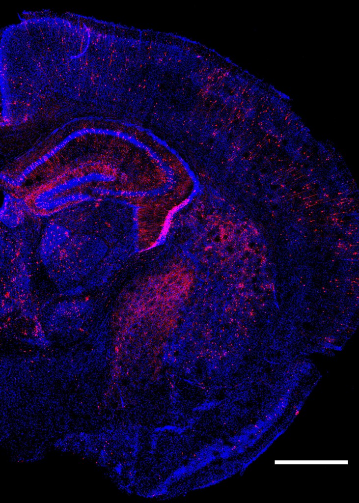 Researchers investigate autism spectrum disorder genes — Harvard Gazette