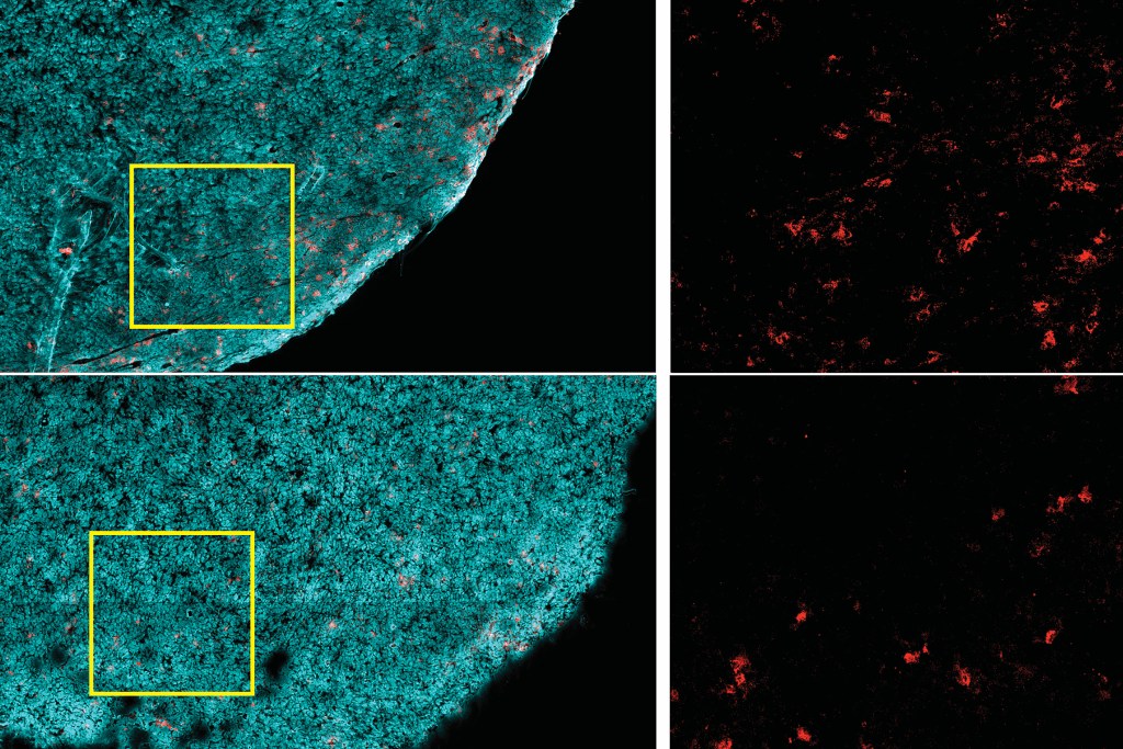 Researchers study relationship between obesity and cancer — Harvard Gazette