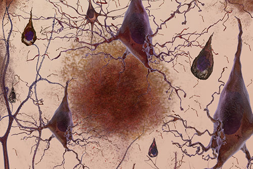 Fixing the way we fix the brain — Harvard Gazette