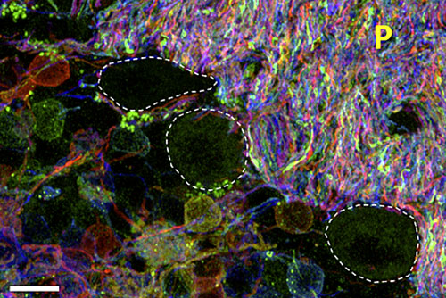 ‘Brainbow,’ version 2.0 — Harvard Gazette