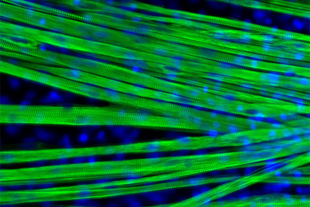 Researchers unveil stem cell models of human spine development ...