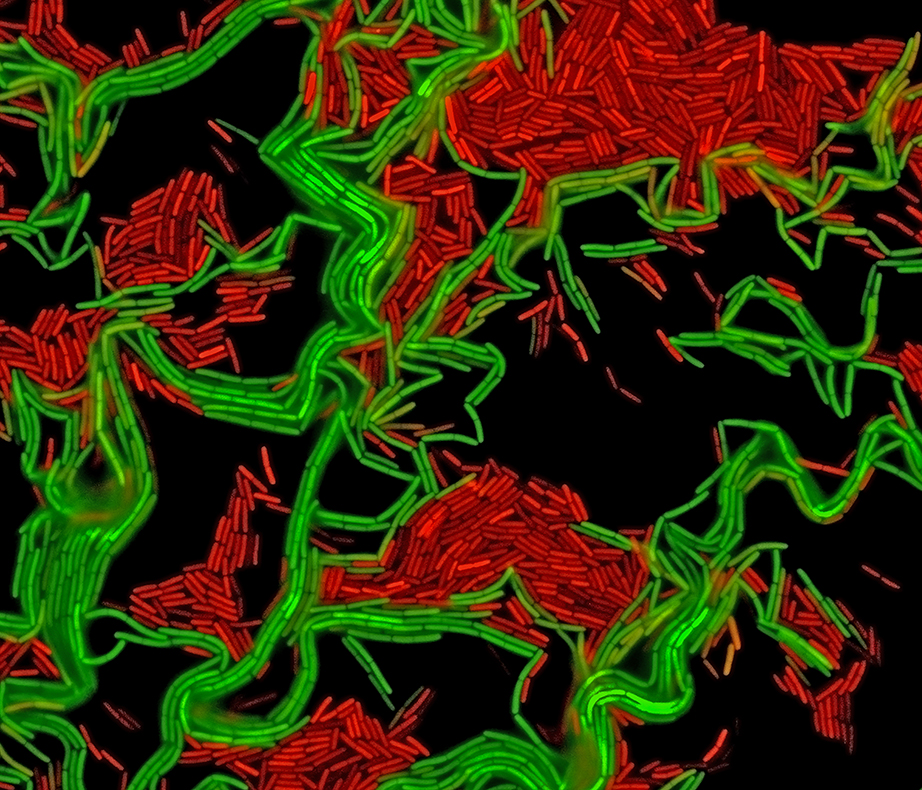 Photos reveal strange beauty of microbes — Harvard Gazette