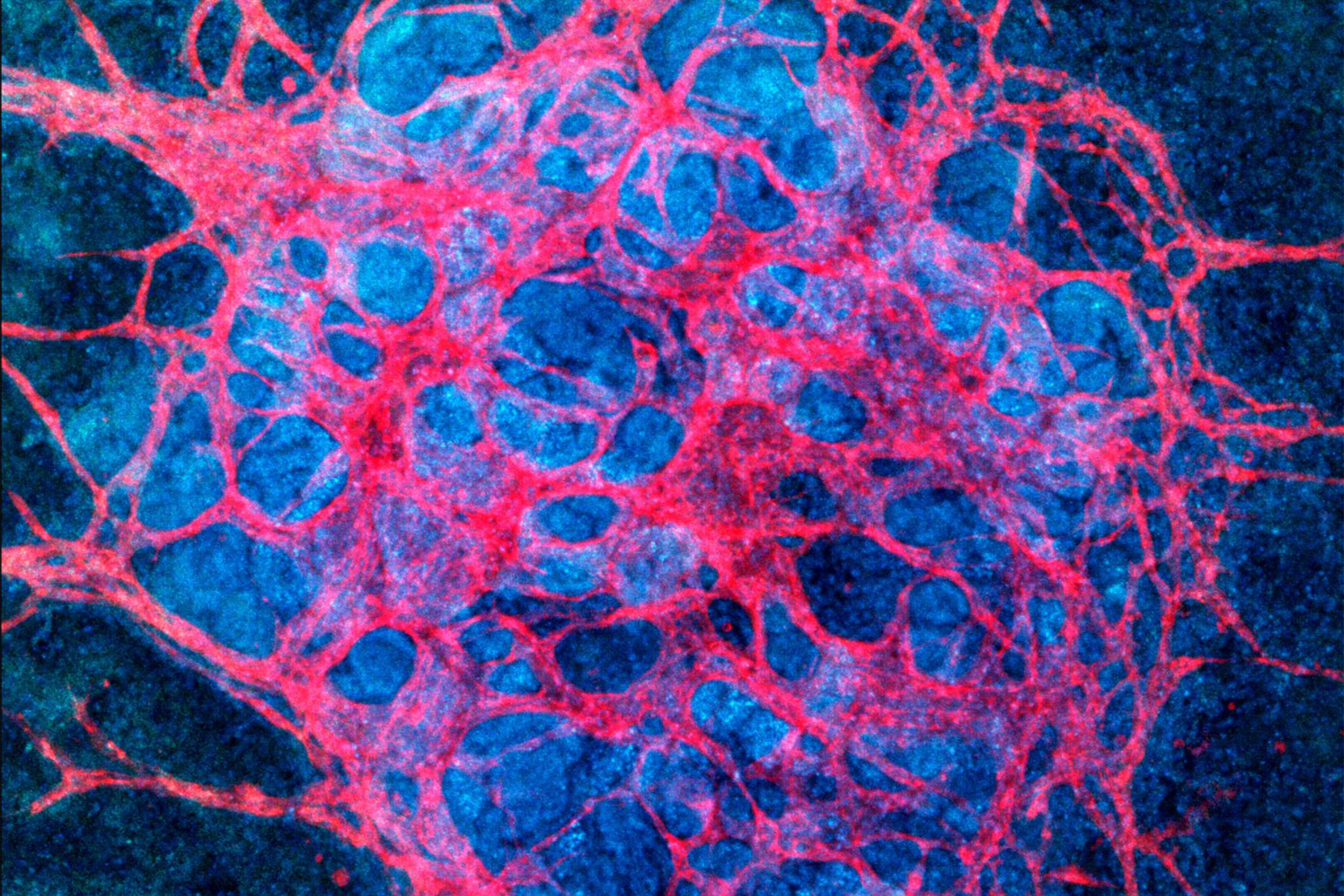 Growing organoids uncovers how cells become organs — Harvard Gazette