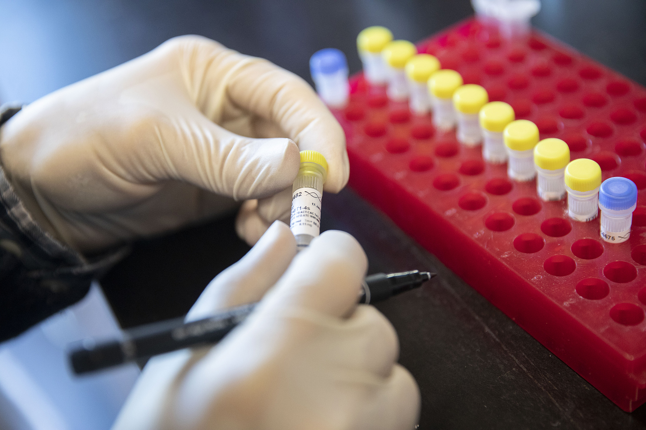 Treatments for touch hypersensitivity explored in new research ...