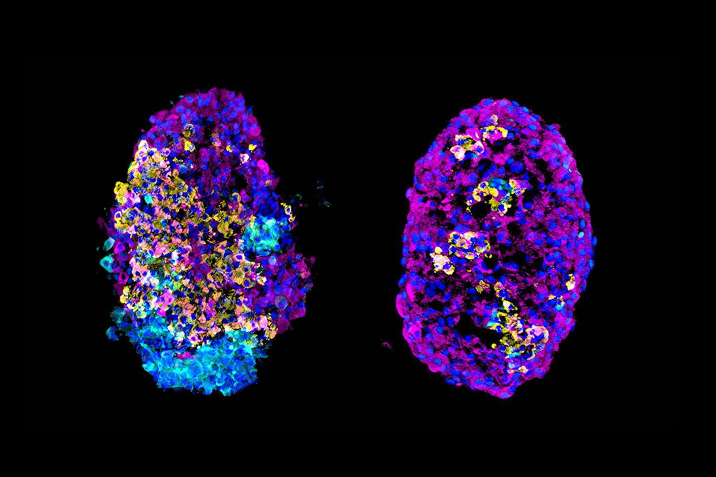 Partnership aims to accelerate cell and gene therapy — Harvard Gazette