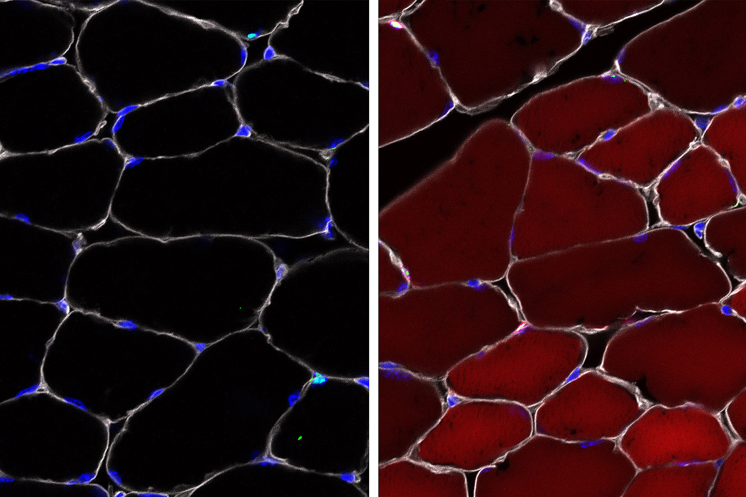 A better gene-transport system targets diseased muscle tissue — Harvard ...