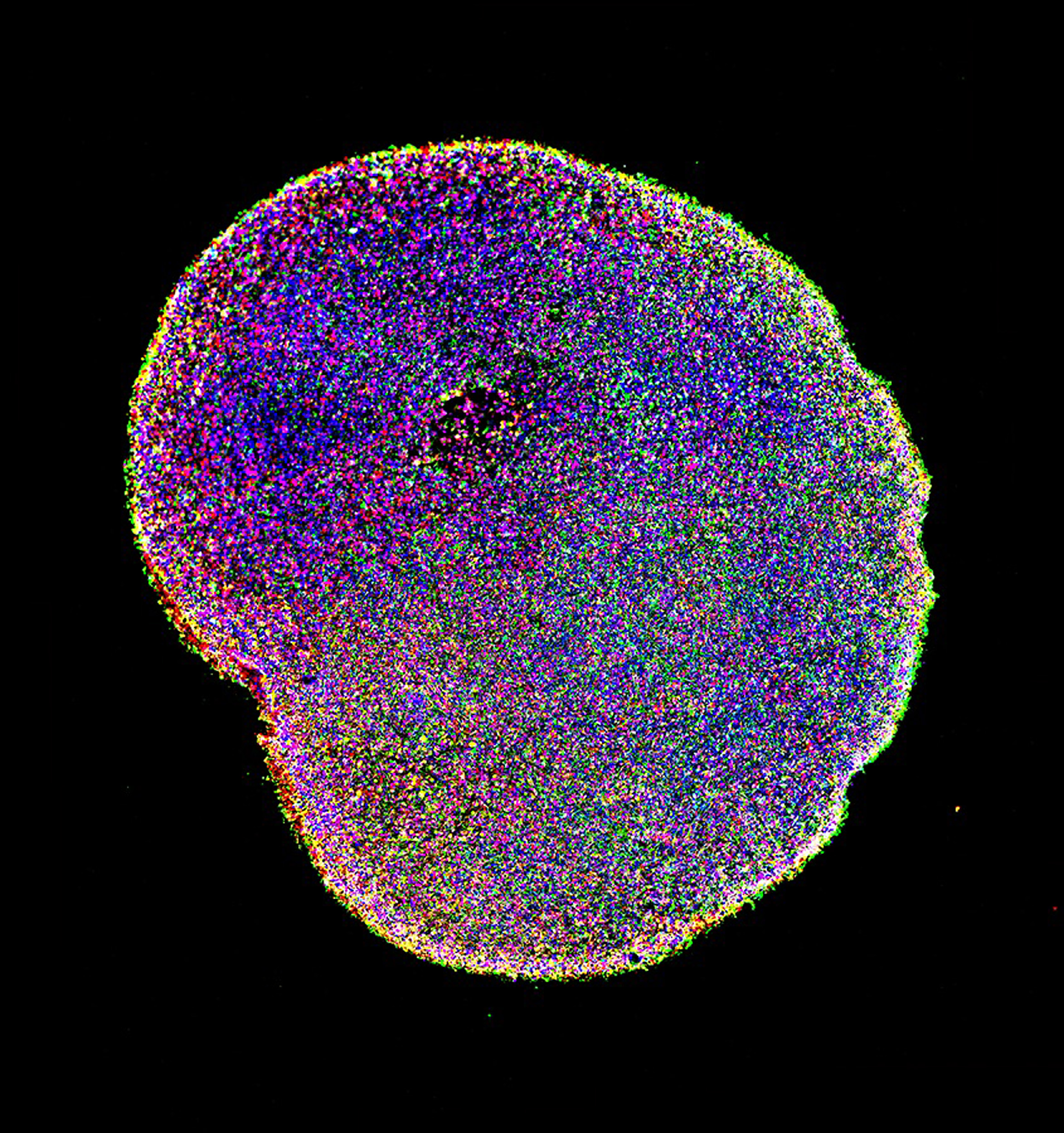 New 3D mini brain models accelerate neuroscience research — Harvard Gazette