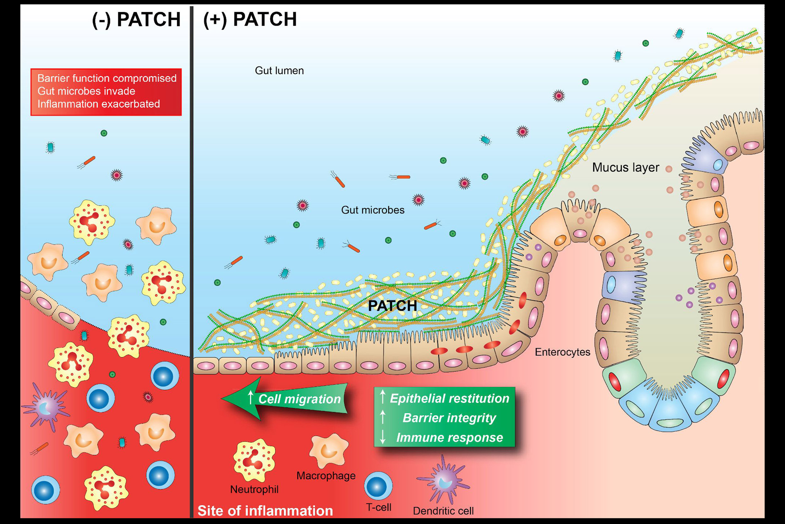 Engineered probiotic developed to treat multiple sclerosis — Harvard ...