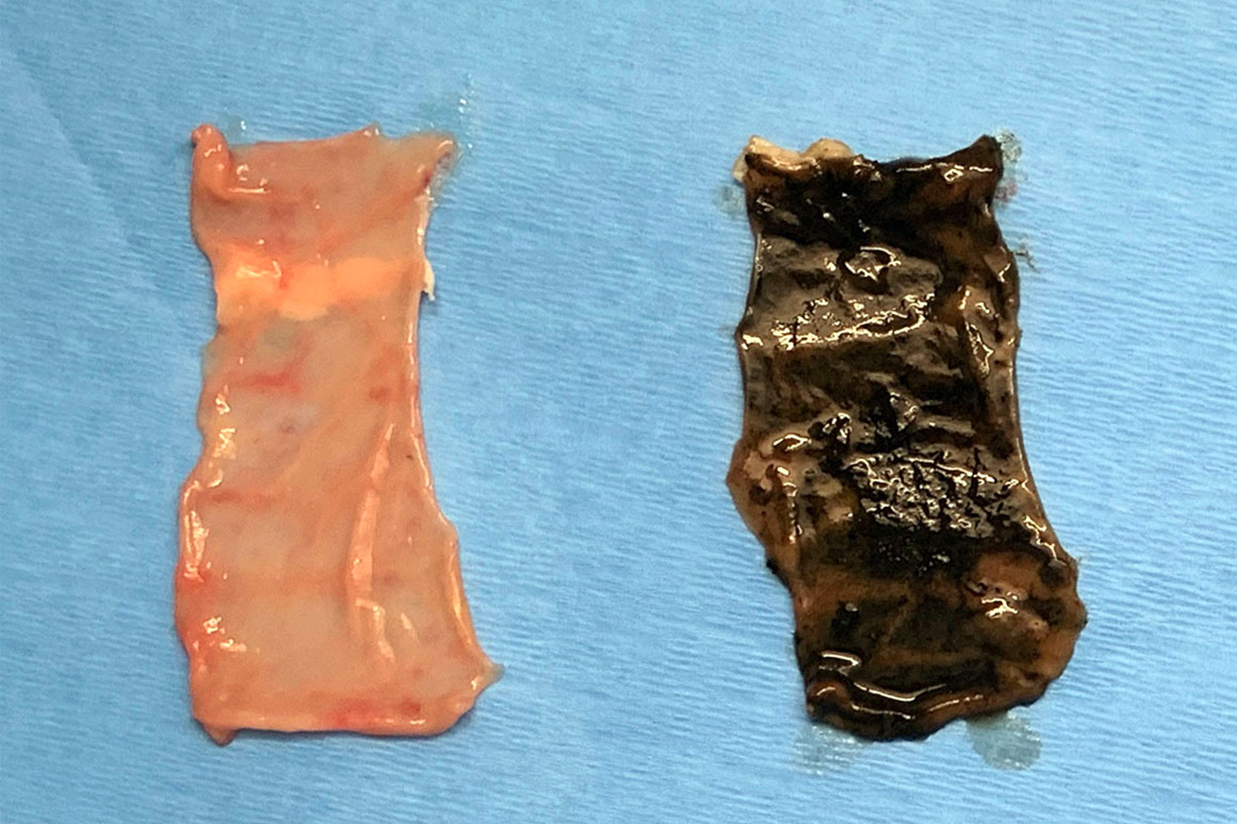 Synthetic lining offers better drug delivery to small intestine ...