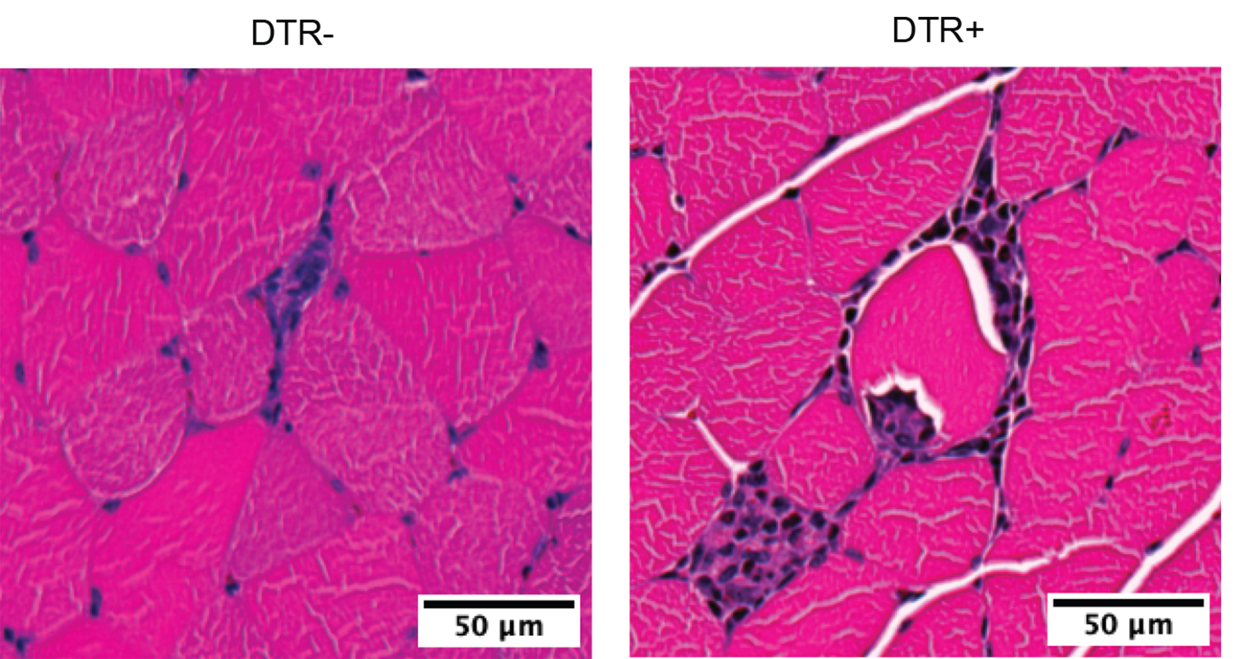 New study explains how exercise reduces chronic inflammation — Harvard ...