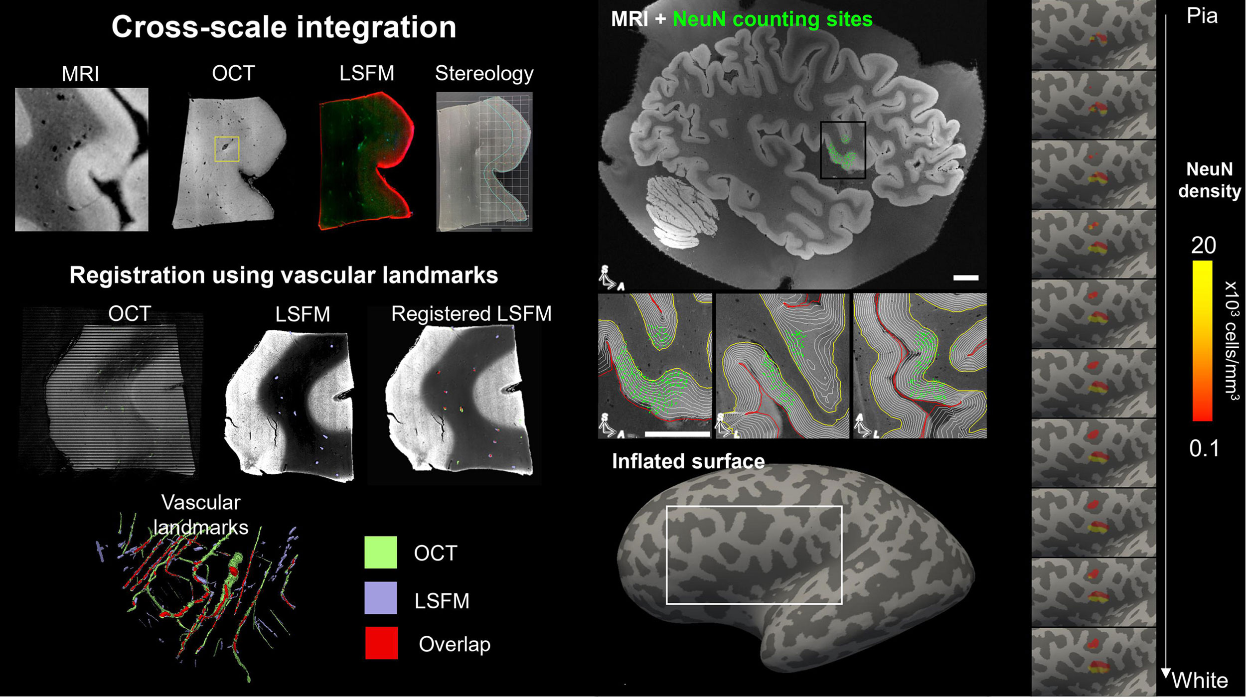 Innovative imaging maps area of brain linked to speech — Harvard Gazette