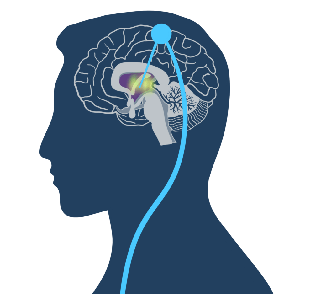 A win for science, and patients, against brain injury ‘nihilism ...