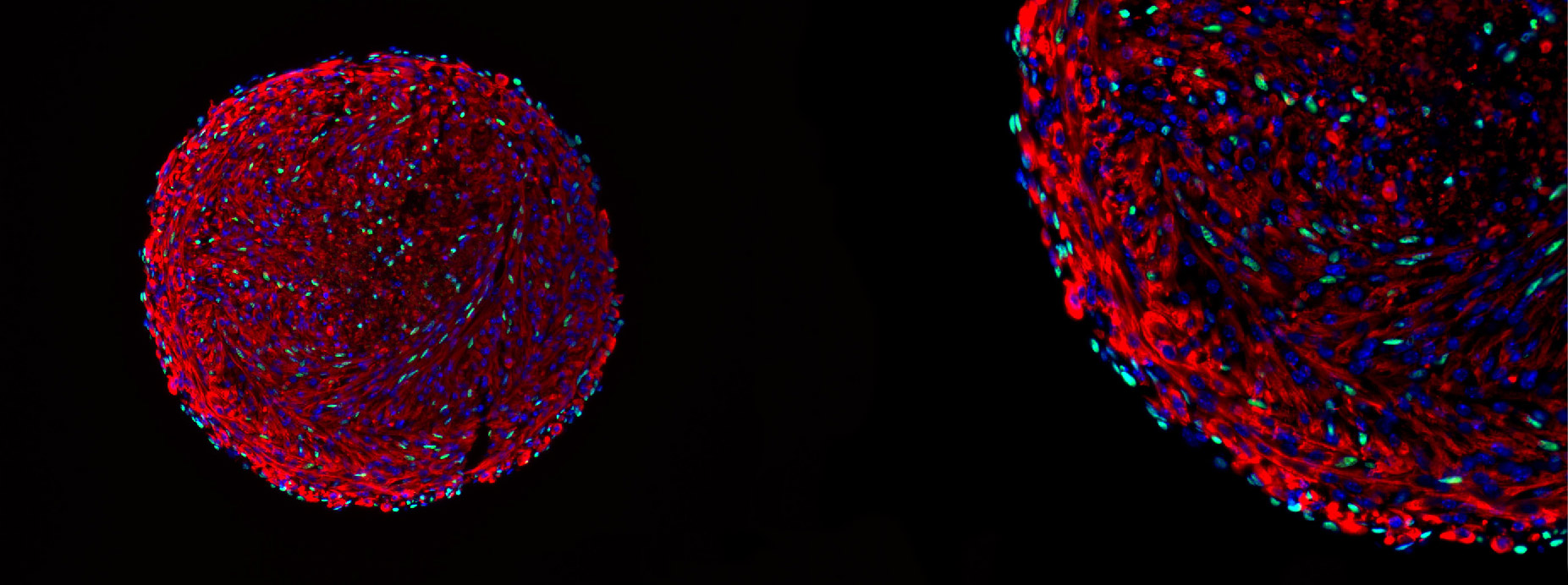 Breakthrough technique may help speed treatment of MD, ALS — Harvard ...