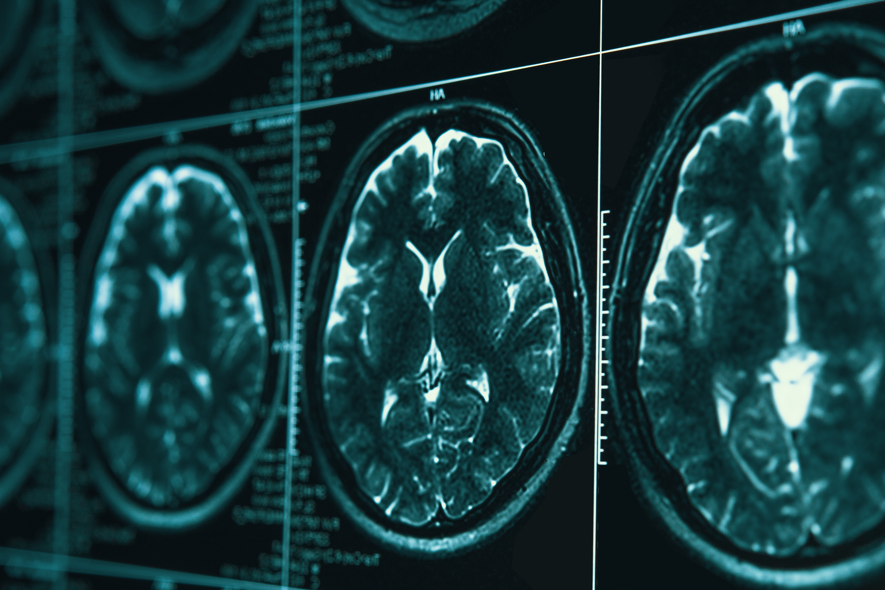‘Brainbow,’ version 2.0 — Harvard Gazette