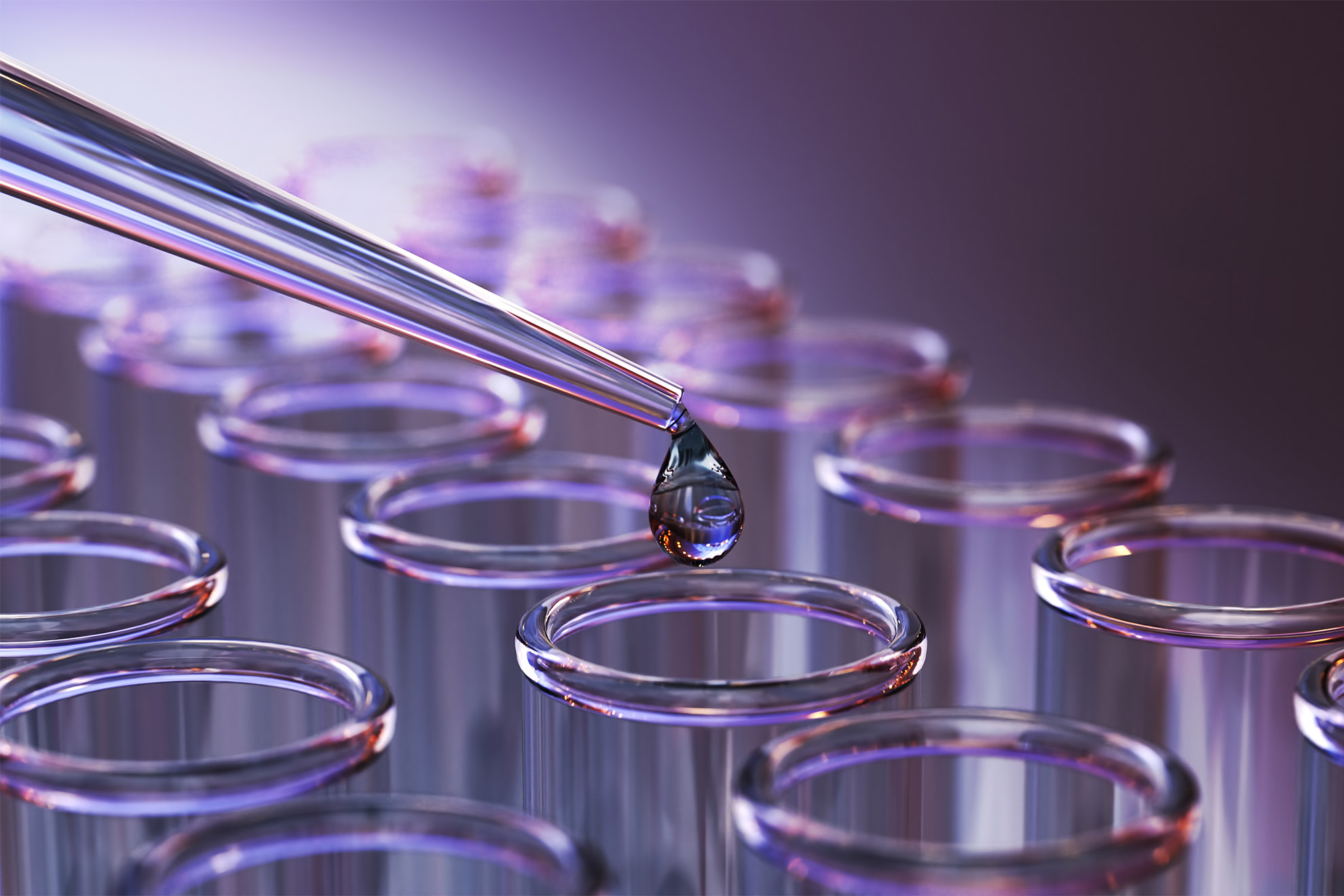 Team hits milestone toward prion disease treatment — Harvard Gazette